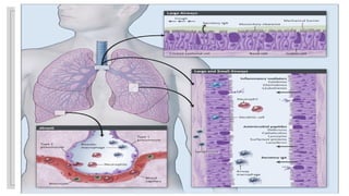 PULMONARY DEFENSE MECHANISM Pulmonary.pptx