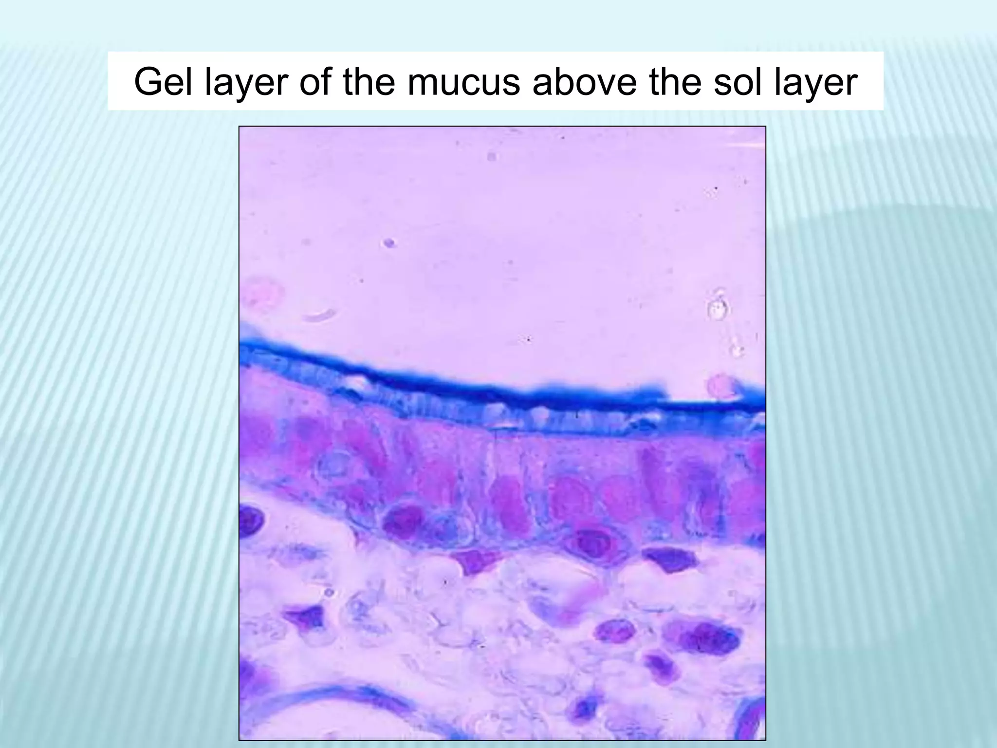 Pulmonary defense mechanisms | PPSX