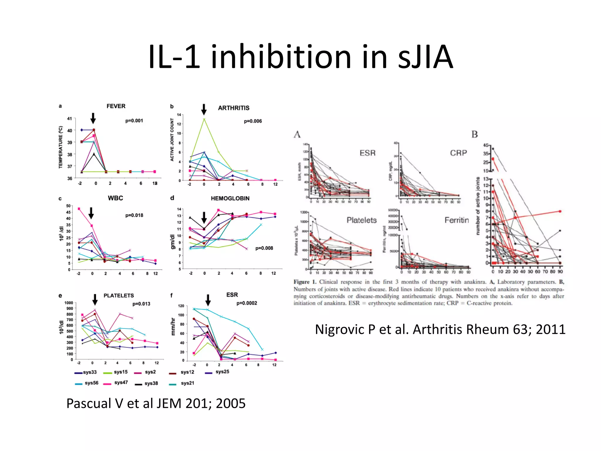 Rare Pulmonary Diseases in Systemic JIA | PPT