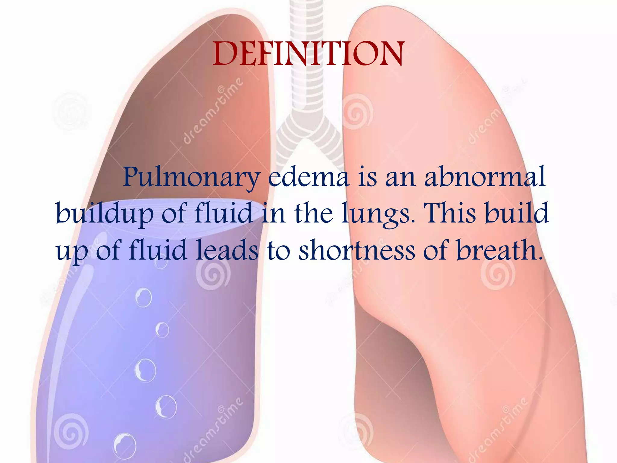 Pulmonary edema | PPTX