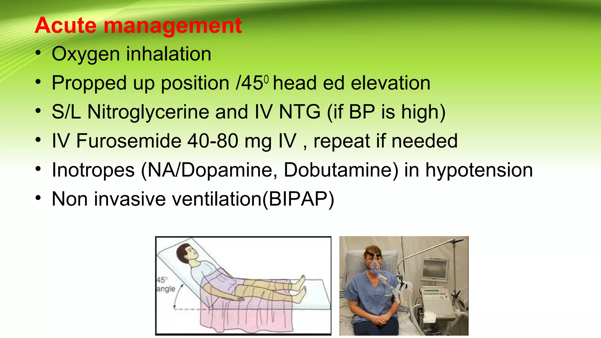 Pulmonary edema | PPT