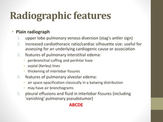 Pulmonary edema.pptx
