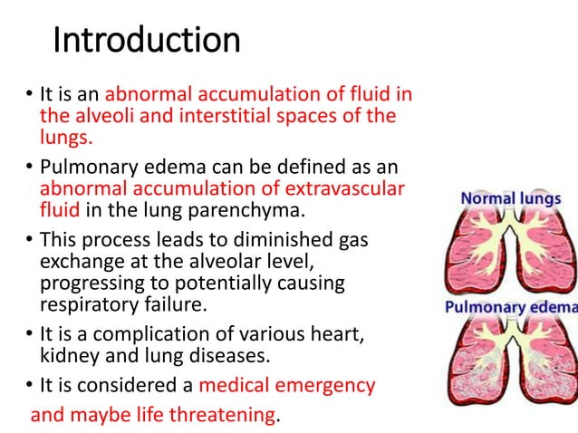 Pulmonary edema.pptx