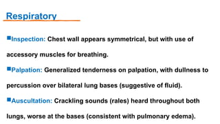 pulmonary edema health unilateral pulmonary edema.pptx