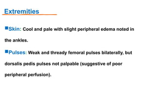 pulmonary edema health unilateral pulmonary edema.pptx