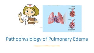 pulmonary edema health unilateral pulmonary edema.pptx