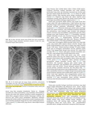 Pulmonary Edema - Imaging Manifestations_compressed id (1).docx