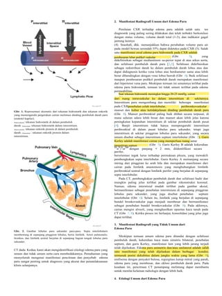 Pulmonary Edema - Imaging Manifestations_compressed id (1).docx