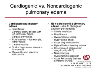 Pulmonary edema & Management | PPTX