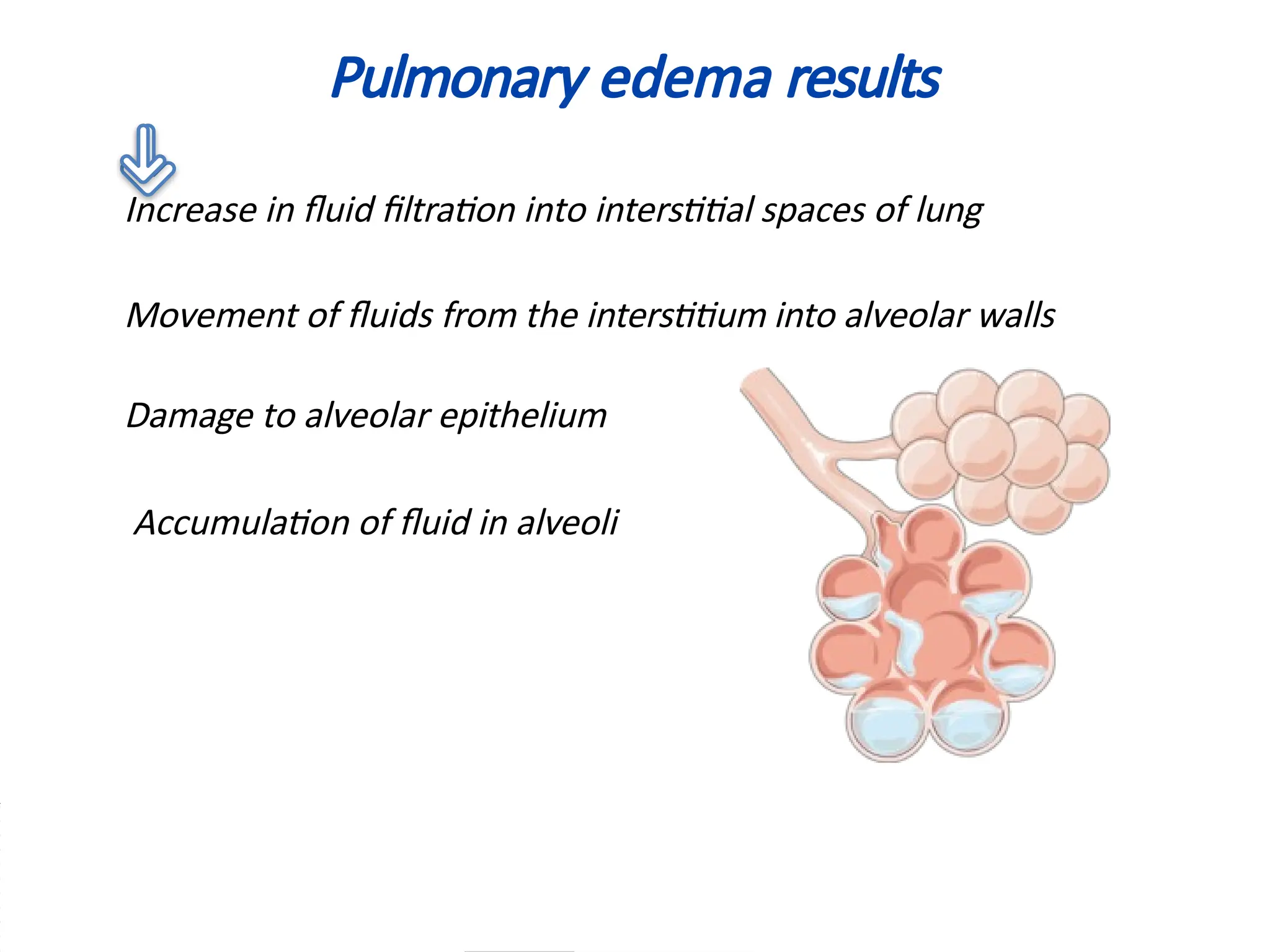 Pulmonary edema classification,management and its anesthetic ...