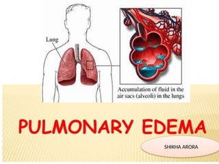 pulmonary edema ppt.pptx Pulmonary edema | PPTX
