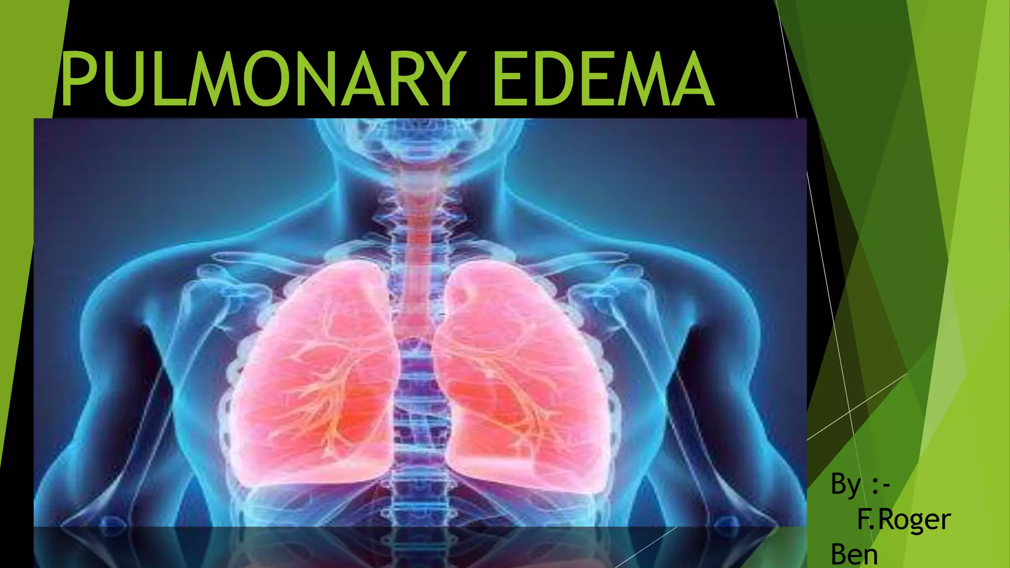 Pulmonary edema roge ppt (1) | PPTX