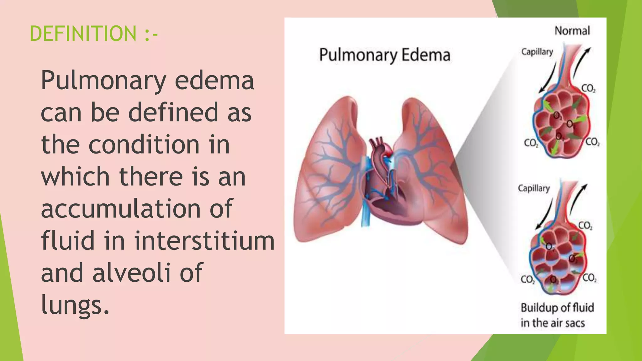 Pulmonary edema roge ppt (1) | PPTX