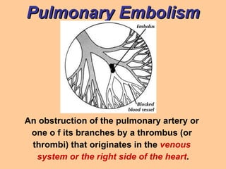 Pulmonary embolism | PPT