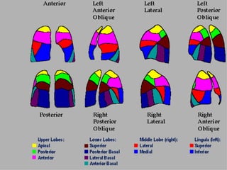 Lung Segments Vq
