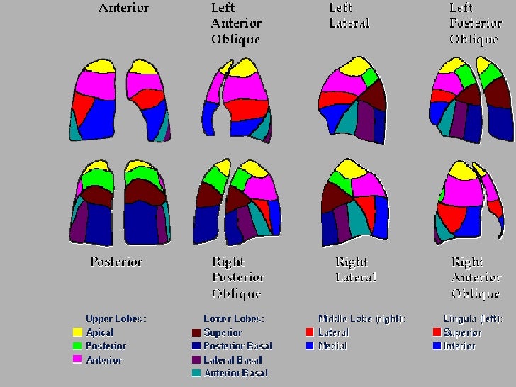 Pulmonary embolism and lung scans