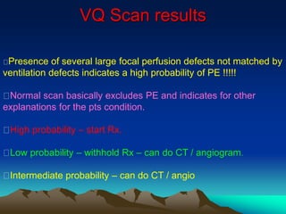 Pulmonary embolism,overview | PPTX