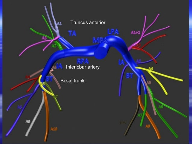 Pulmonary embolism