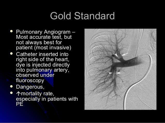 Pulmonary Embolism - (PE)