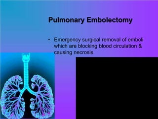 Pulmonary embolism | PPT