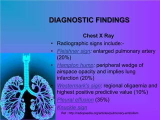 Pulmonary embolism | PPTX