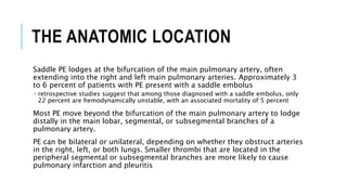 Pulmonary embolism | PPTX