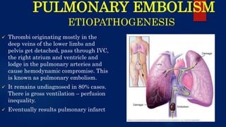 Pulmonary embolism- Venous diseases | PPT