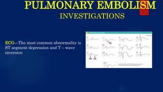 Pulmonary embolism- Venous diseases | PPT