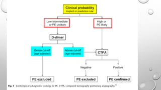 Pulmonary embolism | PDF