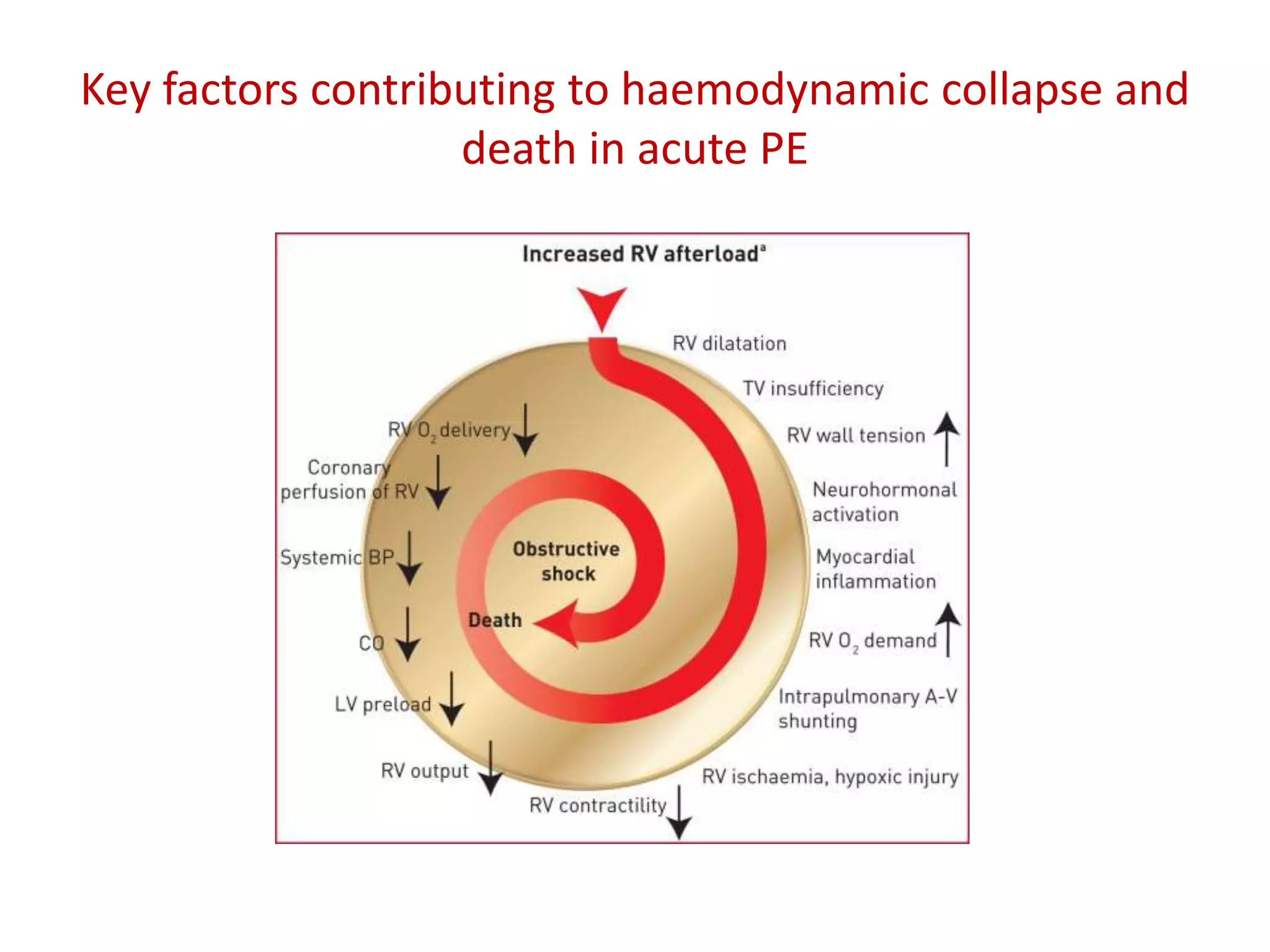 Pulmonary embolism | PPTX