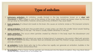 Pulmonary embolism | PPTX