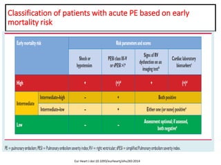 Pulmonary embolism | PPTX