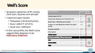 Pulmonary embolism | PPTX
