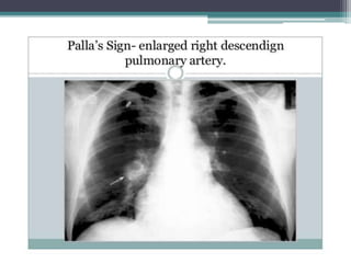 Pallas Sign