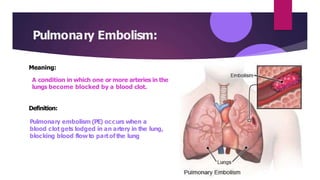 PULMONARY EMBOLISM.pptx