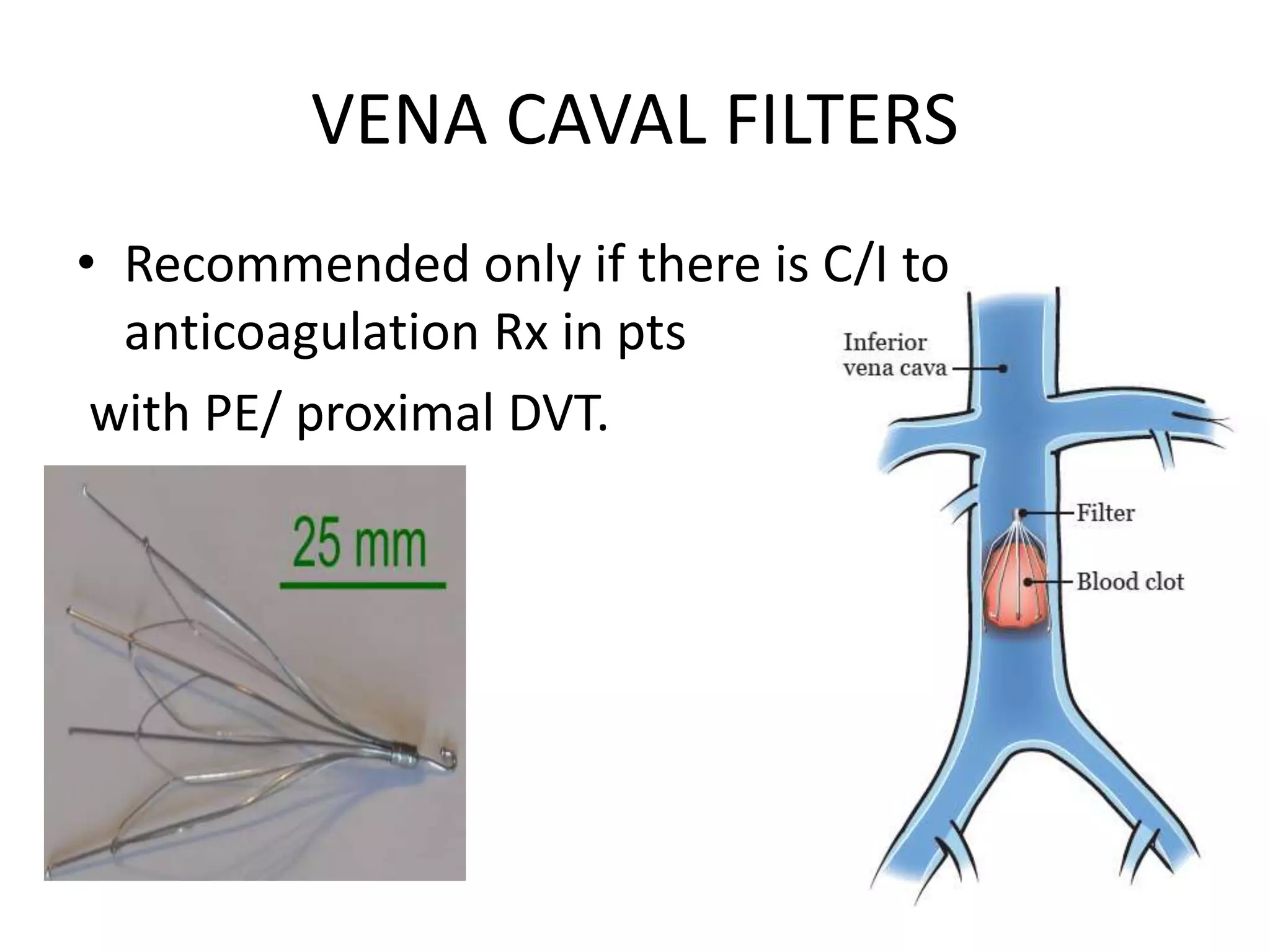 Pulmonary Embolism | PPTX