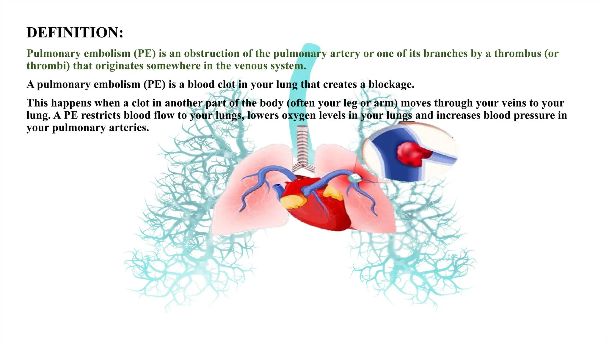PULMONARY EMBOLISM AND ITS MANAGEMENTS.pdf