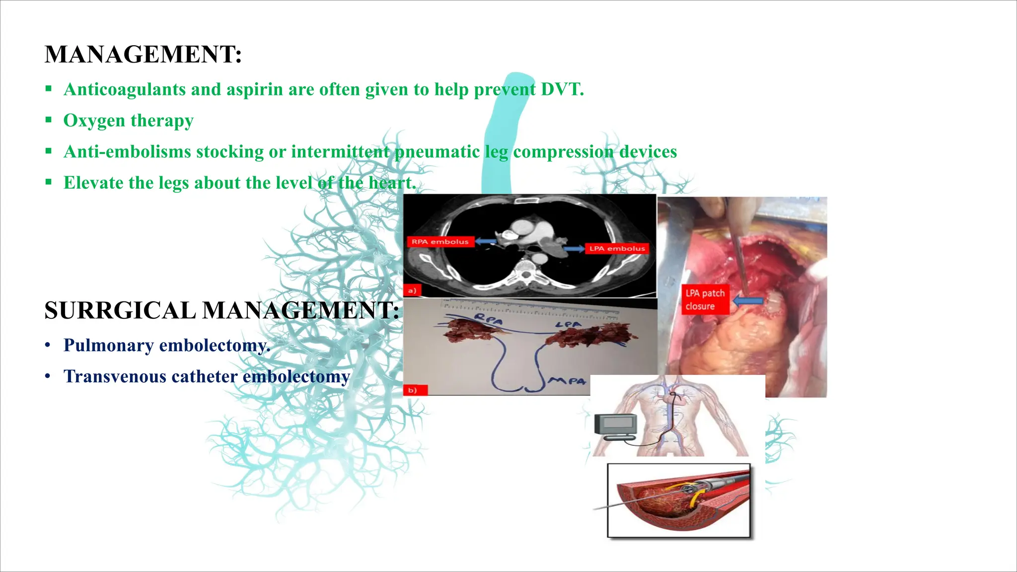 PULMONARY EMBOLISM AND ITS MANAGEMENTS.pdf