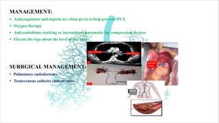 PULMONARY EMBOLISM AND ITS MANAGEMENTS.pdf | Lung and Respiratory ...