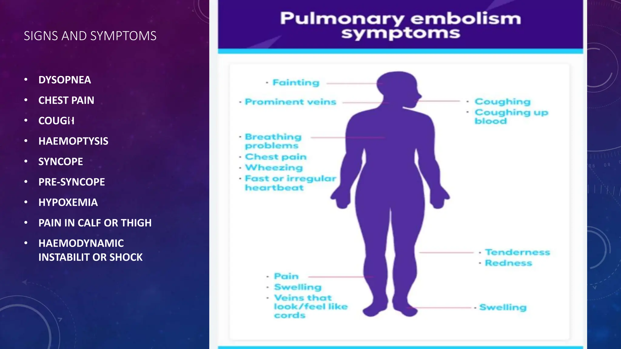 PULMONARY EMBOLISM.pptx and its management | PPT