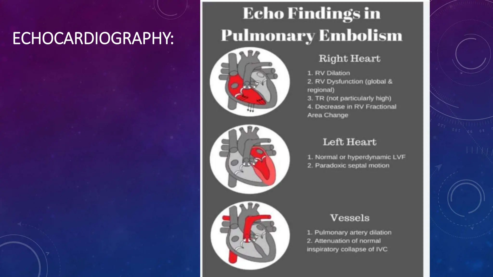 PULMONARY EMBOLISM.pptx and its management | PPT