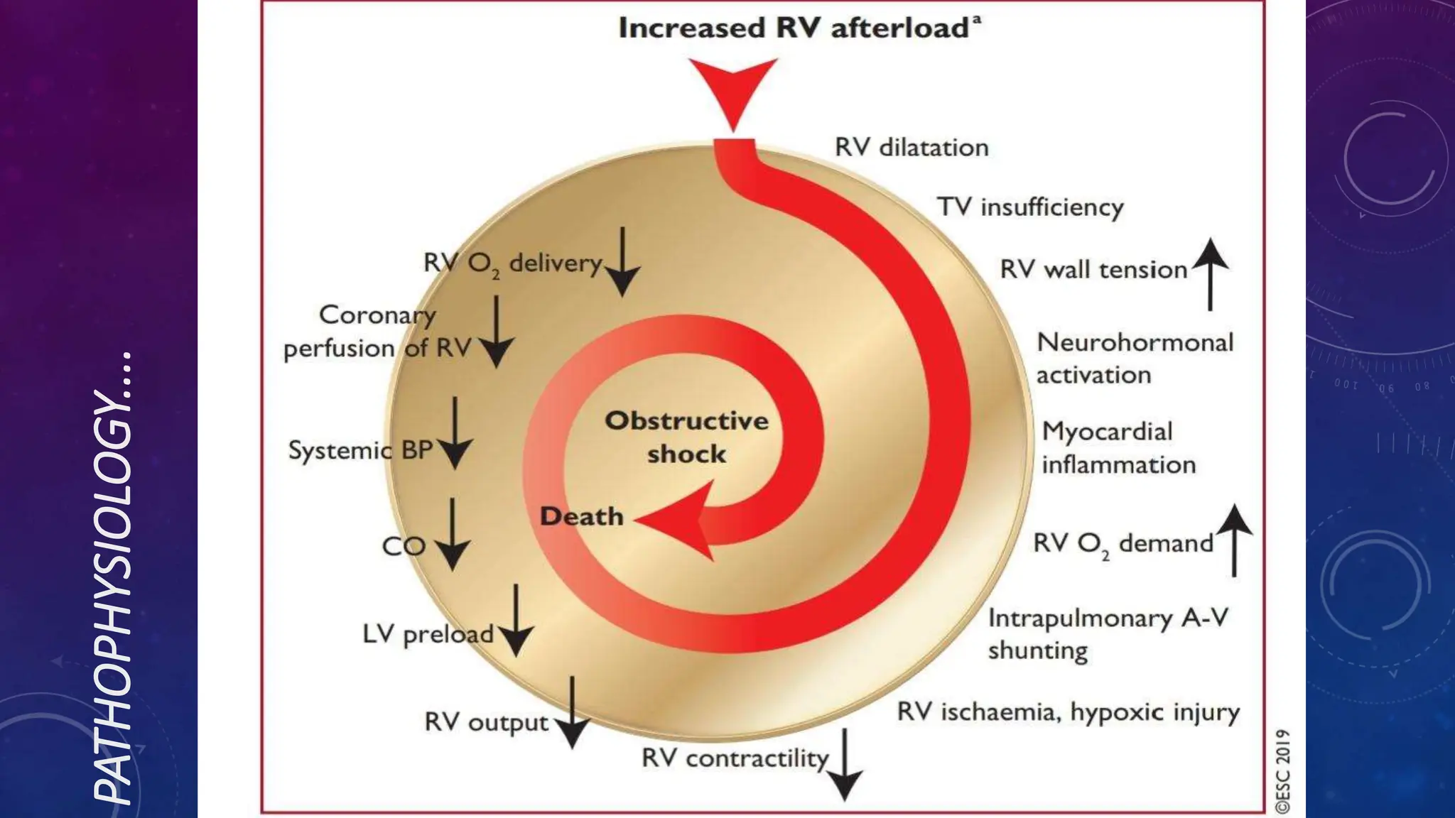 PULMONARY EMBOLISM.pptx and its management | PPT
