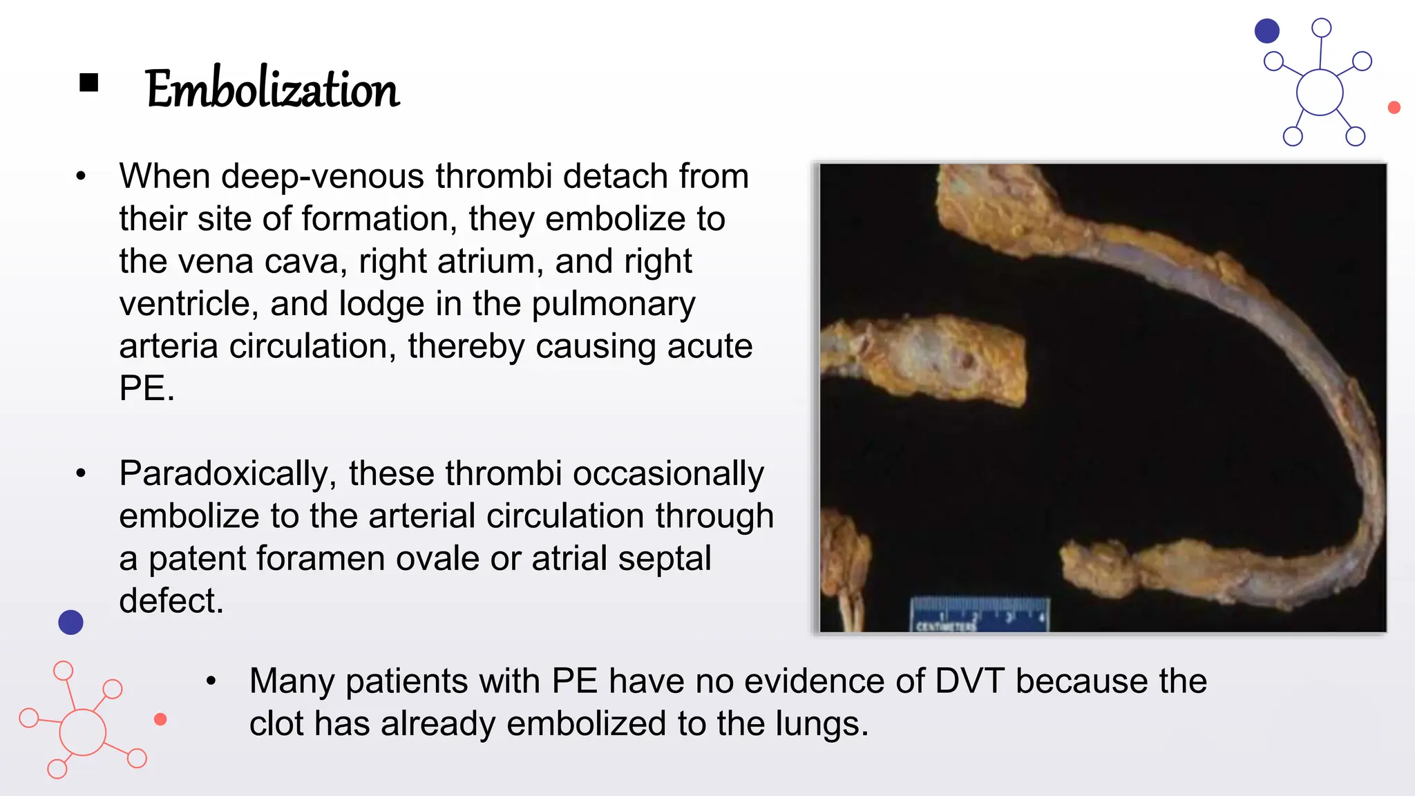 PULMONARY EMBOLISM POWER POINT BOOK.pptx
