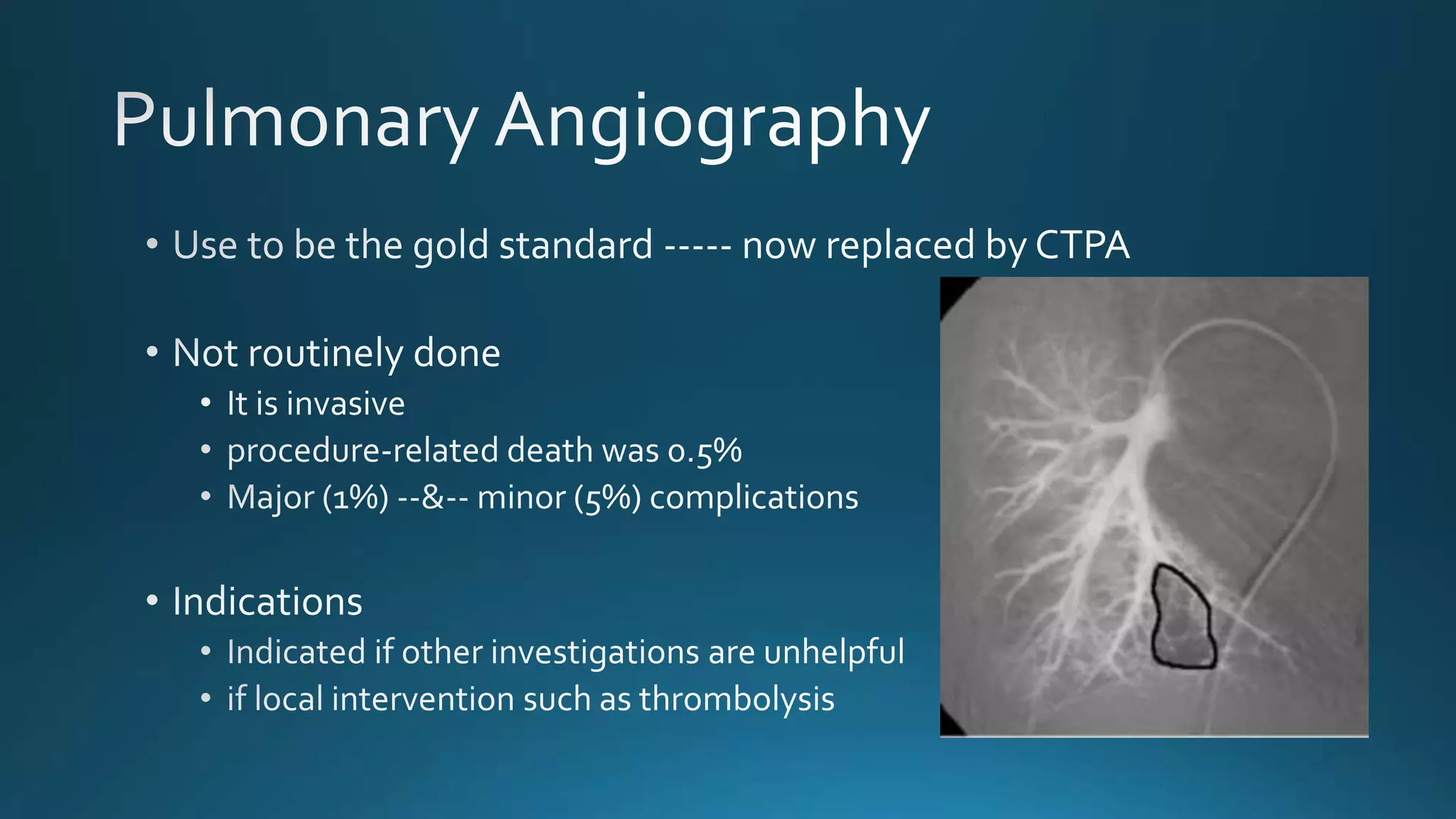 Pulmonary Embolism 1.pptx