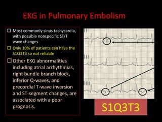 Pulmonary embolism 2 | PPTX