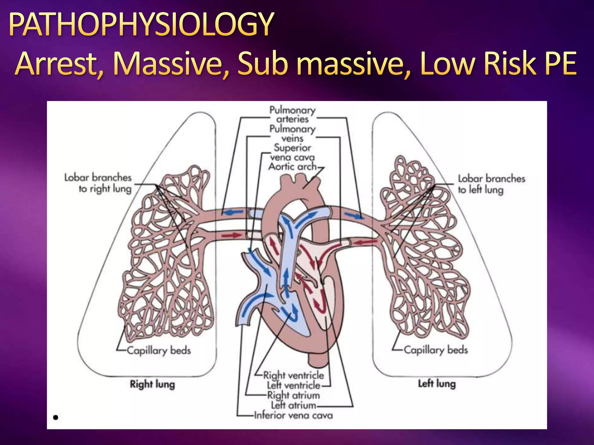 Pulmonary embolism 21jan21 | PPT