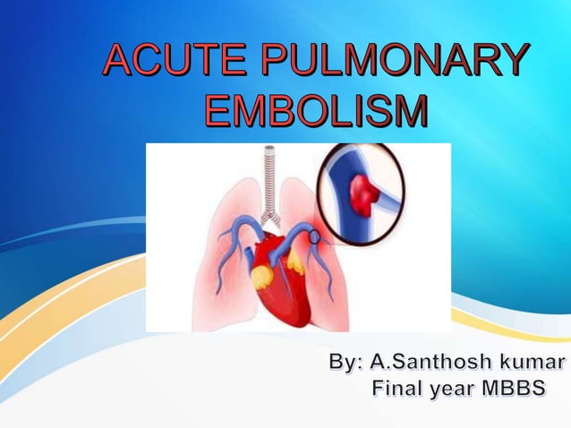 Pulmonary Embolism | PPT