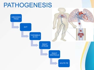 Pulmonary Embolism | PPTX