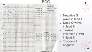 Pulmonary Embolism case presentation (1).pptx