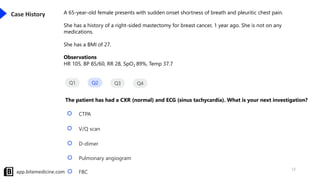 Pulmonary Embolism & Deep Vein Thrombosis - Handout.pdf
